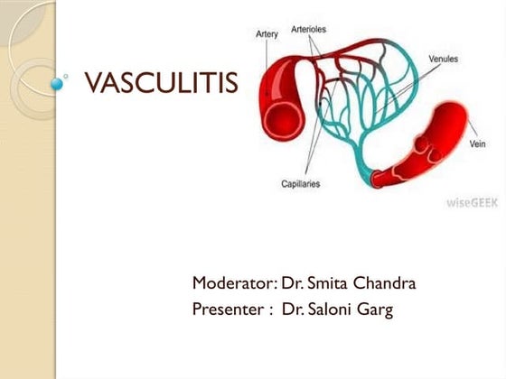 Vasculitis pathology | PPTX