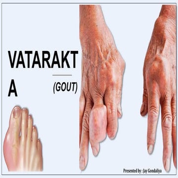 Vata-Rakta vyadhi nidana | PPTX