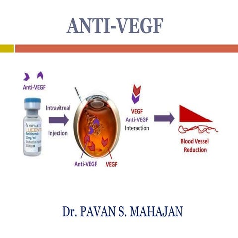 Vegf @ ant vegf | PPTX | Eye and Vision Conditions | Diseases and ...