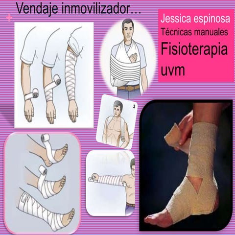 Vendaje inmovilizador | PPTX