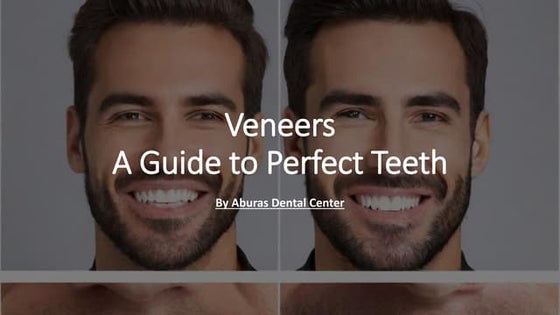 Veneers(1).pptx