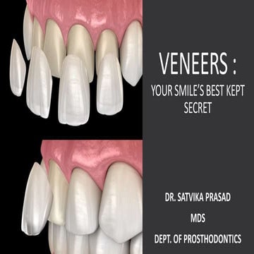 Laminates Veneers in Dentistry | PPTX