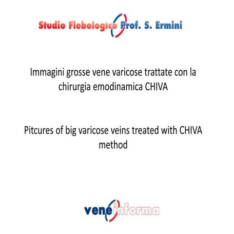 Big Varicose Veins treated with CHIVA Method | PPTX