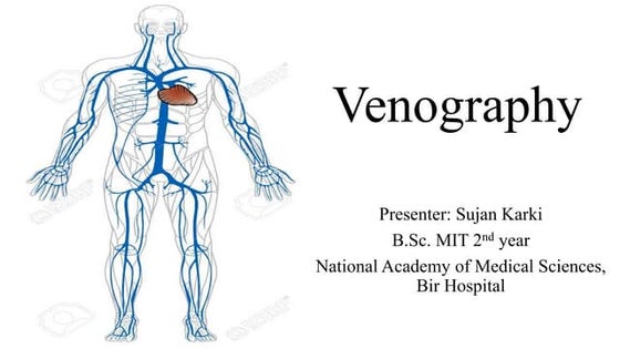 CAROTID AND VERTEBRAL ANGIOGRAPHY.pptx