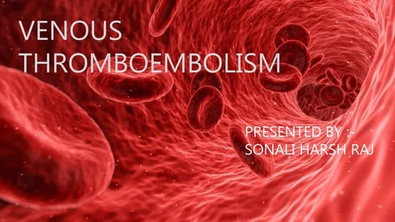 Venous Thromboembolism | PPT