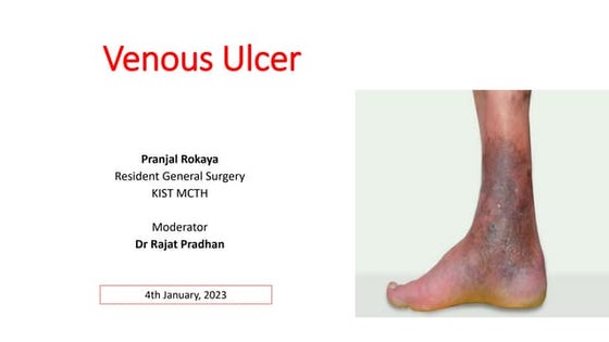 Venous ulceers | PPT