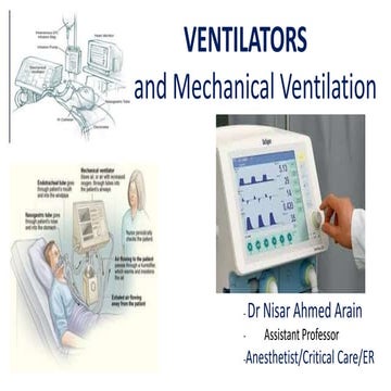 Mechanical ventilation | PPT