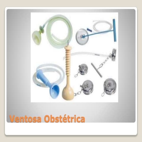 Ventosa obstétrica | PPTX