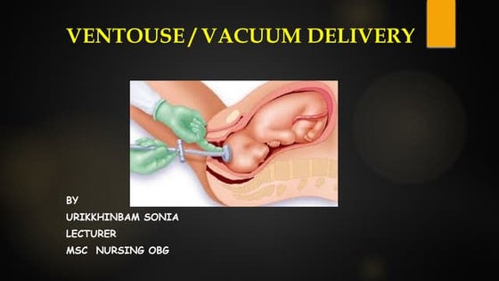Vacuum Delivery | PPTX | Pregnancy | Reproductive Health
