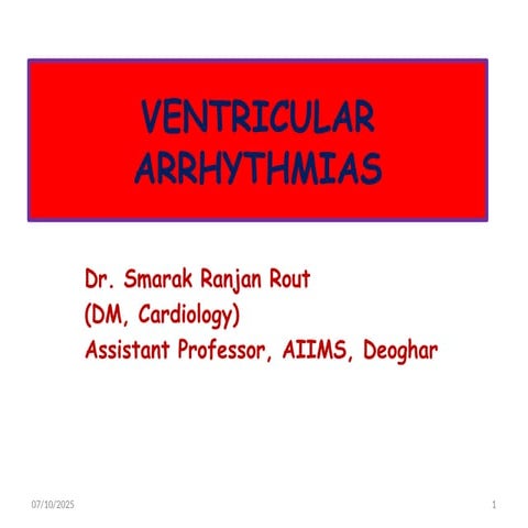 ventricular tachycardia (VT) Localisation | PPT