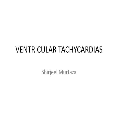 Ventricular tachycardia | PPTX