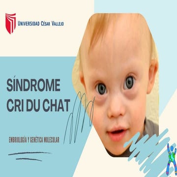 SINDROME CRI DU CHAT | PDF