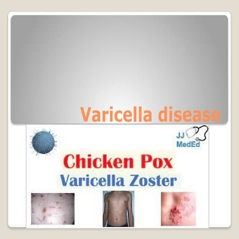 Comprehensive Overview of Varicella (Chickenpox): Symptoms, Treatment ...