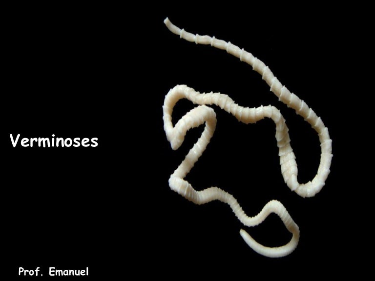Verminoses