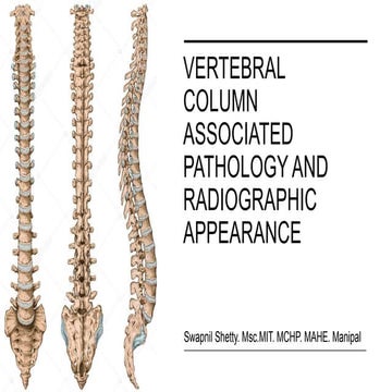 Skull X-Ray | PPTX
