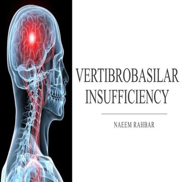 Vertebrobasilar Insufficiency Bow Hunter's Syndrome: An Unusual Case