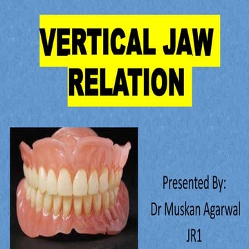 VERTICAL JAW RELATION.pptx