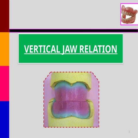 Jaw relation in complete dentures | PPT