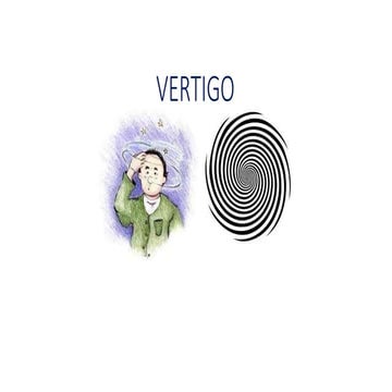 VERTIGO: CAUSES & MANAGEMENT | PPTX