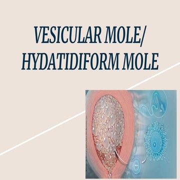 Vescicular mole.pptx