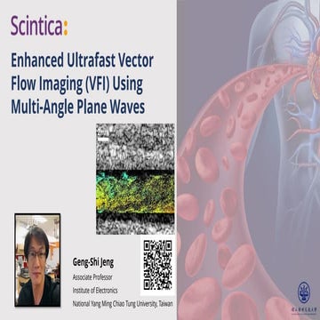 (May 9, 2024) Enhanced Ultrafast Vector Flow Imaging (VFI) Using Multi ...