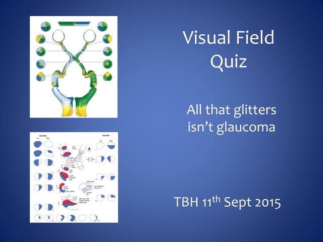 Visual Field Defects Pptx