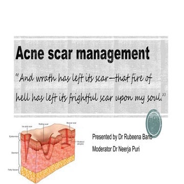 Acne scar management | PPTX