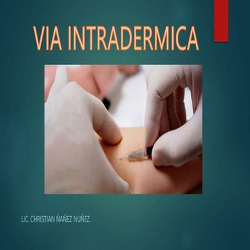 Administración intradérmica | PPT
