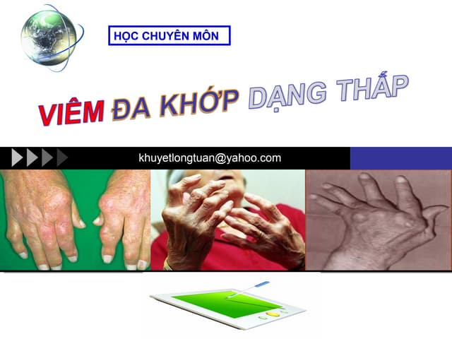 BÀI GIẢNG LUPUS BAN ĐỎ HỆ THỐNG | PDF