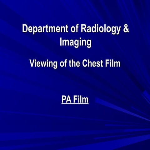 Learn Chest X-Ray With Its Normal Positioning & Radio-Anatomy | PPTX
