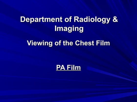 Chest X-Ray Anatomy. | PPTX | Lung and Respiratory Health | Diseases ...