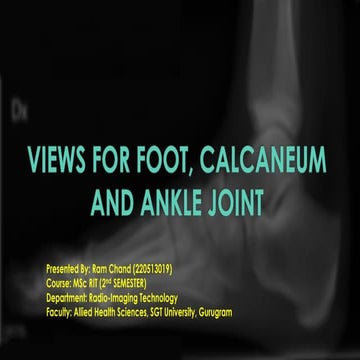 Normal Ankle and foot Radiographs by Dr Avinash | PPTX