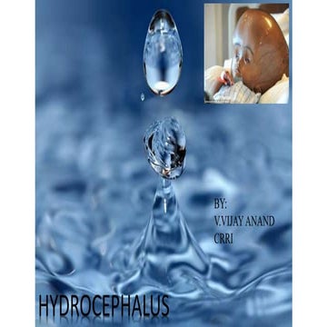 HYDROCEPHALUS MEANING WATER IN HEAD. BIG HEAD AND AGE RELATED ...