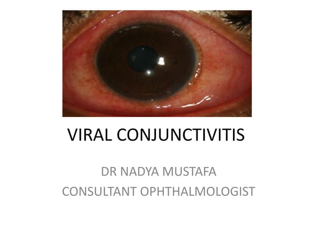 Conjunctivitis | PDF