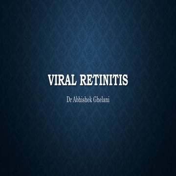 Viral retinitis | PPTX