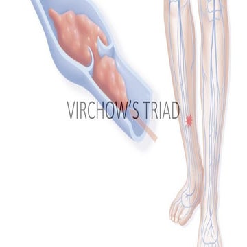 The Knowledge of Virchows Triad and its core | PPTX