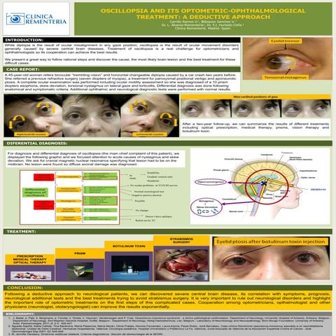 OSCILLOPSIA AND ITS OPTOMETRIC-OPHTHALMOLOGICAL TREATMENT: A DEDUCTIVE ...