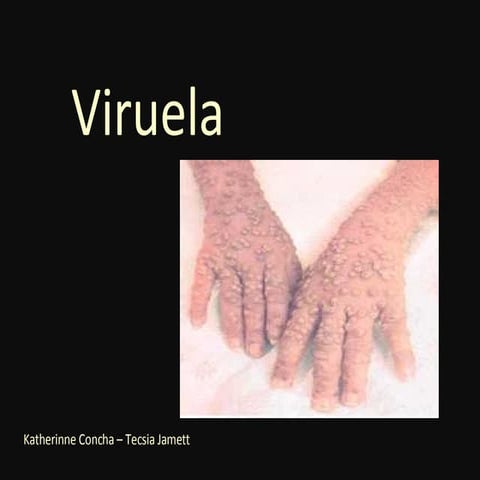 Viruela | PPT