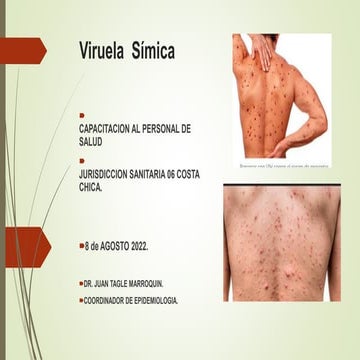 Viruela simica | PPTX