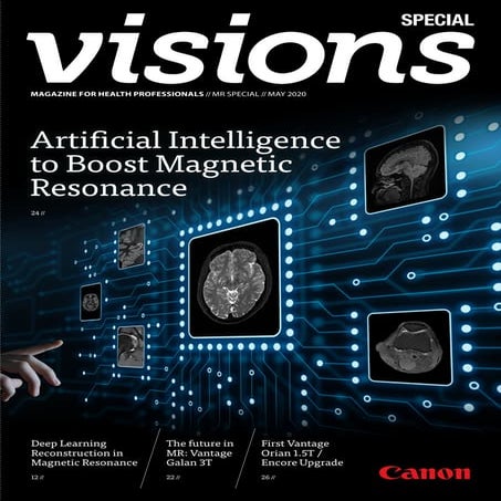 brochure of philps mri 7700 latest system | PDF