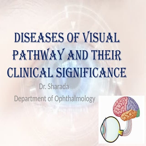 visual pathway diseases and clinical significance pptx | PPTX