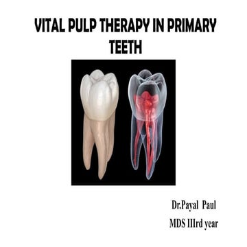 Direct and indirect pulp capping | PPTX