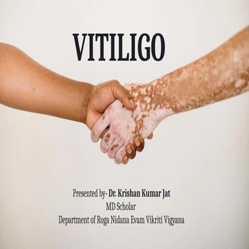 vitiligo presentation .pptx TOPIC VITILGO IN | PPTX