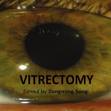Vitrectomy.............................. | PDF