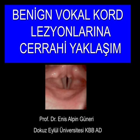 Vokal kord lezyonları | PDF