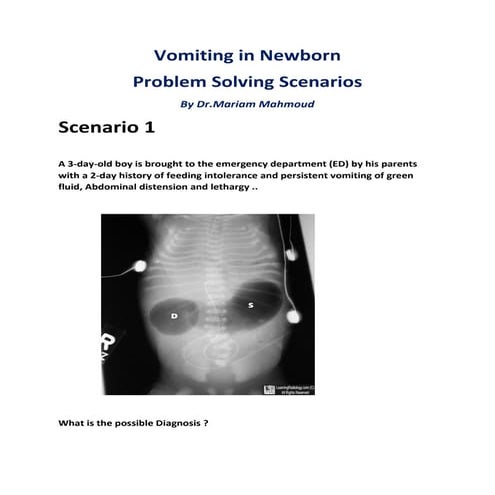 Vomiting in newborn | PDF