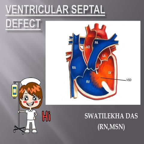 Ventricular Septal Defect with Nursing Management | PDF