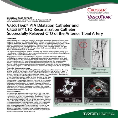 Vt crosser-clinical-case-study | PDF