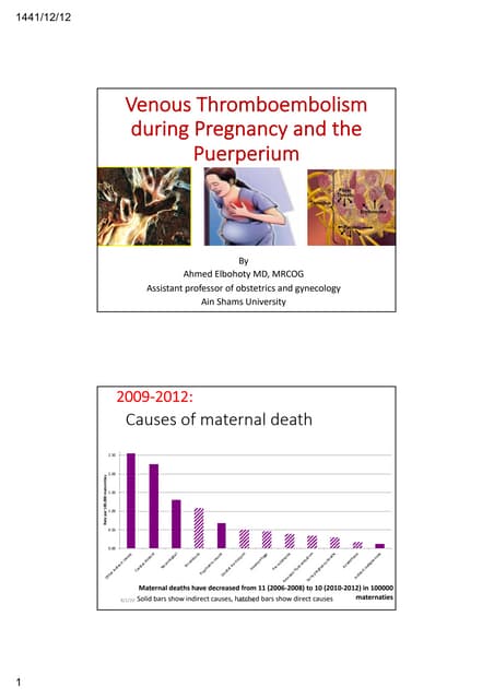 VTE risk factors RCOG GUIDELINE APPENDIX | PDF