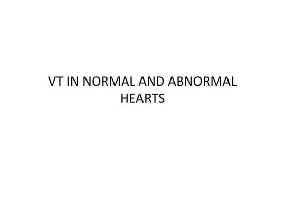 ECG -Ventricular tachycardia localisation .pptx